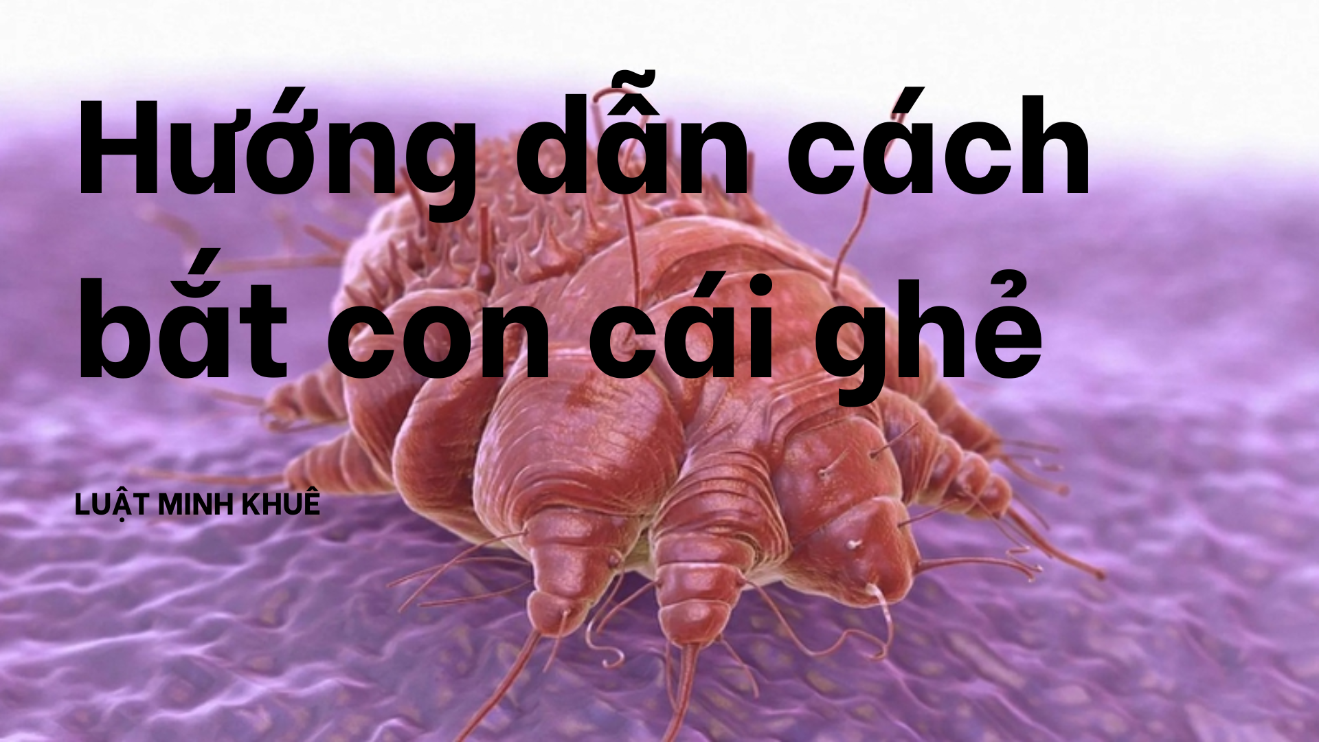 Hướng dẫn cách bắt con cái ghẻ