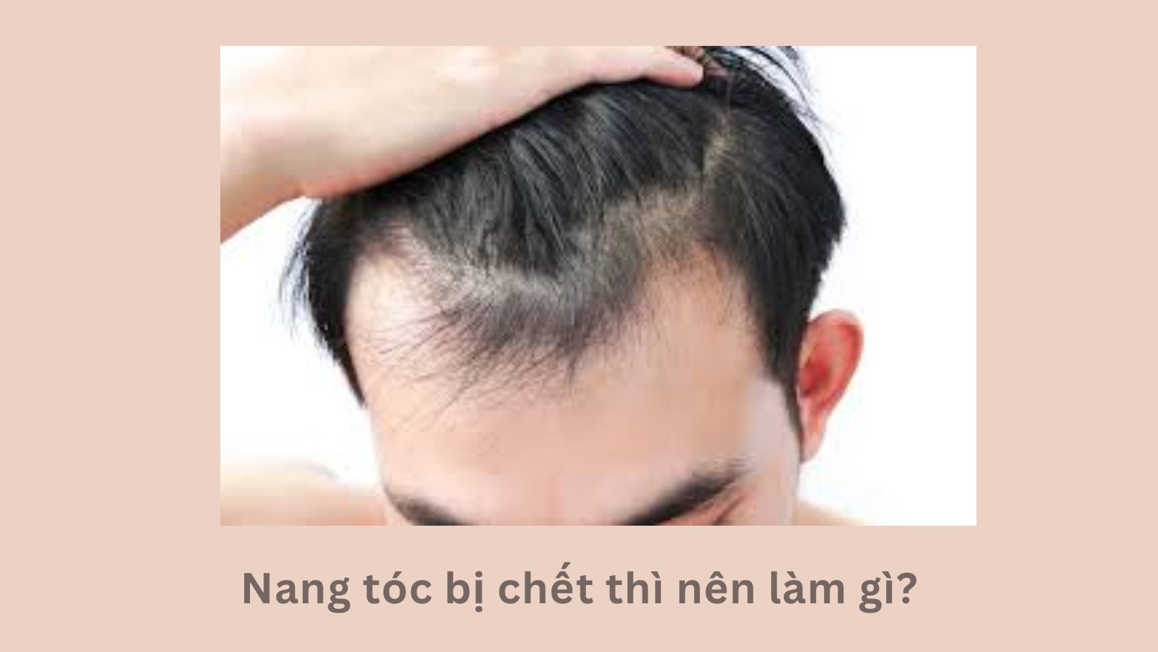 Nang tóc bị chết thì nên làm gì?